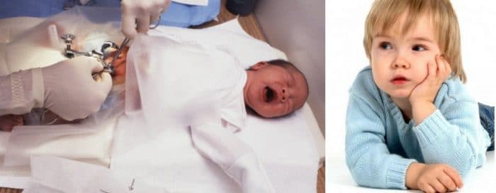 La circoncision : Entre le rituel et la religion, la thérapeutique s ...